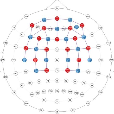 Optode Placement During Functional Near Infrared Spectroscopy Fnirs