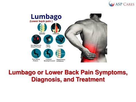 PPT Lumbago Or Lower Back Pain Symptoms Diagnosis And Treatment PowerPoint Presentation ID