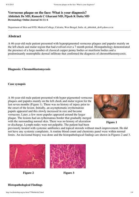 Pdf Verrucous Plaque On The Face What Is Your Diagnosis
