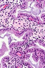 Secretory Phase Endometrium Libre Pathology