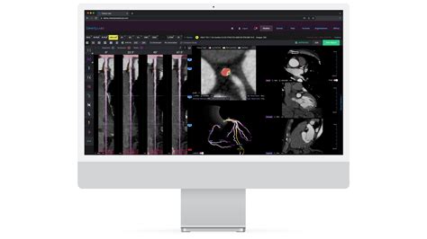 Cleerly Heart Analysis In New Jersey Imagecare Centers