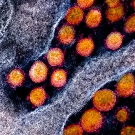 《科学》热议：新冠病毒的遗传物质会插进人的基因组！mit科学家首次发现新冠病毒序列与人基因组整合的证据丨科学大发现腾讯新闻