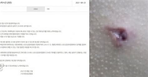 전문 가장 엄중한 대응 할 것 양궁부 후배 활로 쏜 中3 사건에 입 열어
