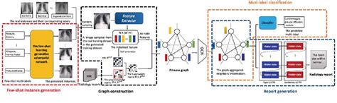 Figure 3 From Few Shot Radiology Report Generation For Rare Diseases Semantic Scholar