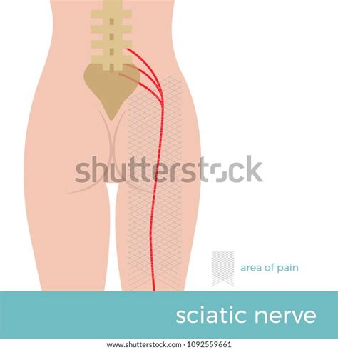 Sciatic Nerve Anatomy Illustration Showing Schematic Stock Vector