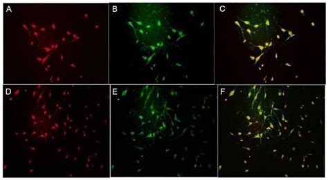 Effects Of Treatment With Ginsenoside Rg1 And Oxygen Glucose