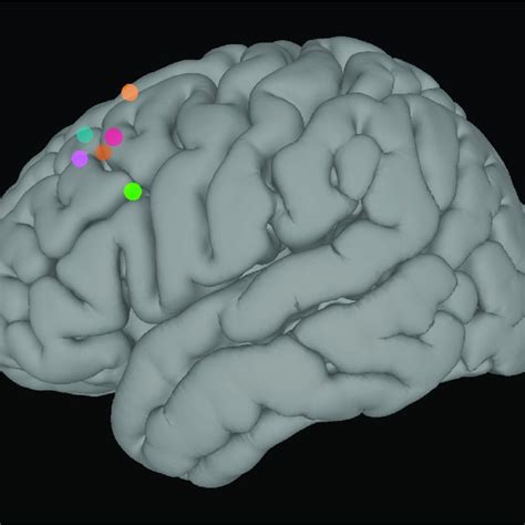 Individualized Left Dorsolateral Prefrontal Cortex Targets Download Scientific Diagram