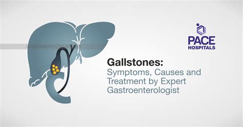 Gallstones Symptoms Causes And Treatment By Best Gastroenterologist
