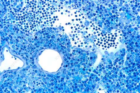 Lymph Node Medulla Light Micrograph Stock Image C0606466