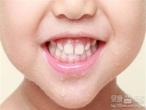 白白的牙齿word文档在线阅读与下载无忧文档
