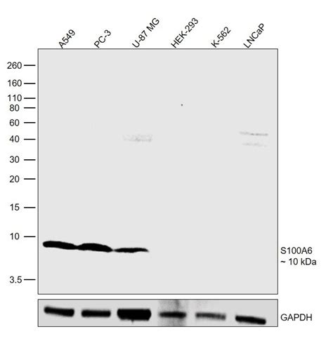 S100a6 Antibody Pa5 31862