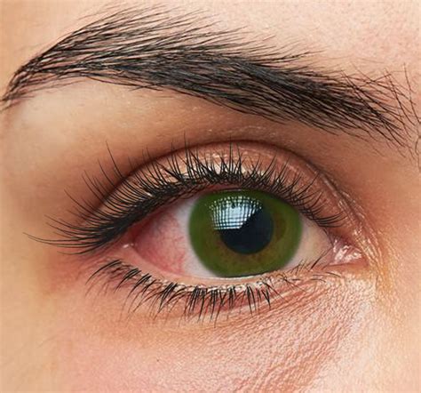 Understanding Eyelash Extension Allergic Reactions Causes And