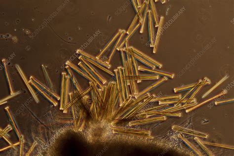 Synedra Sp Diatoms Light Micrograph Stock Image C056 6111 Science Photo Library