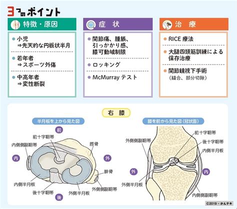 1分間でコレだけは覚えるコレだけシート 152｜半月板損傷 臨床ナース メディカlibrary