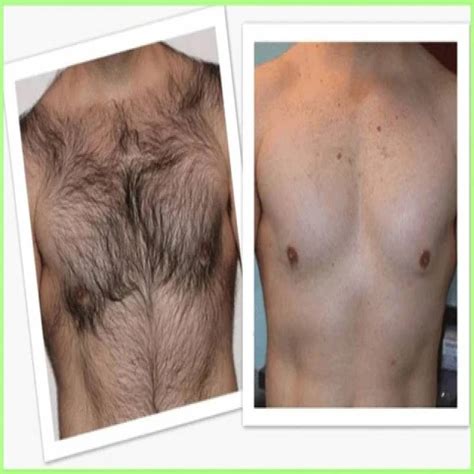 Dream Store Bd Semi Permanent Hair Removal Spray