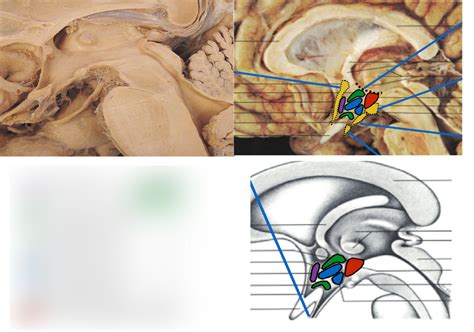 Hypothalamus Anatomical Borders Diagram Quizlet