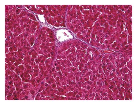 Ce Ameliorates Hepatic Fibrosis In Rats With Ccl4 Induced Liver Damage