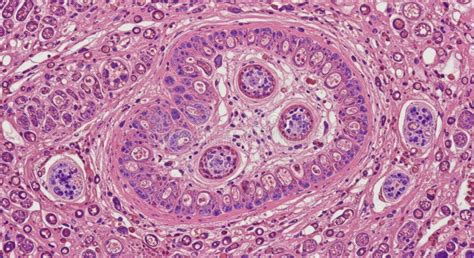 Microscopic View Of Glandular Tissue Detailed Microscopic Of Glandular