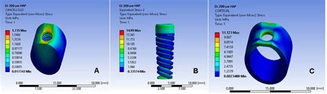 Induced Stress Distribution For Combination 2 A Cancellous Bone Download Scientific Diagram