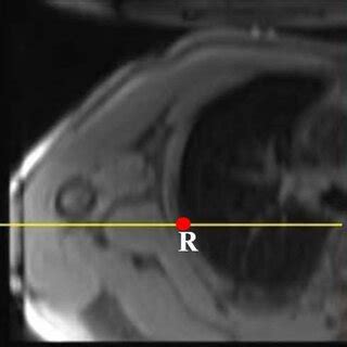 The Figure Shows The Position Of Points L And R The Location Of Points