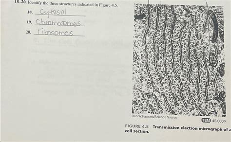 Solved 18-20. ﻿Identify the three structures indicated in | Chegg.com