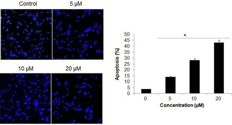 Dapi Staining Assay Images Presenting The Apoptotic Cell Morphology And Download Scientific
