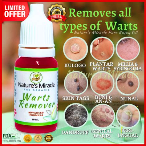 Nature S Miracle Warts Remover Pure Kasoy Oil Warts Remover Original
