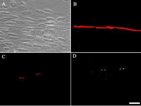 4 Immunocytochemical Characterization Of Node Of Ranvier Formation On