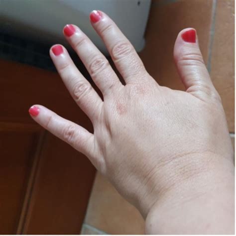 Reflexology Lymphatic Drainage Yoga And Shiatsu En Sotogrande