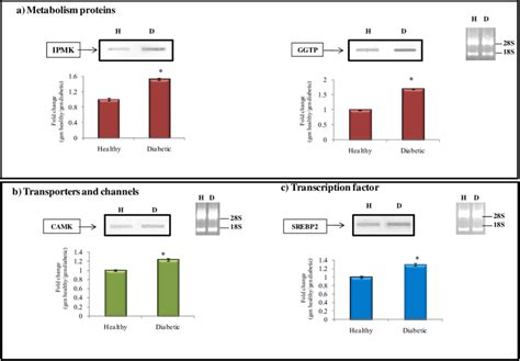 Northern Blot Analysis Performed In Selected Genes Of The Up Regulated