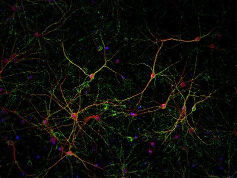 B 27™ Plus Neuronal Culture System