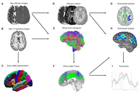Mri Processing Pipeline A And B Raw Diffusion Weighted And