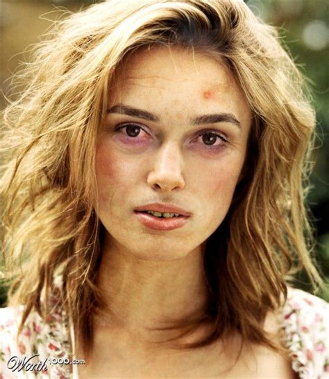 Vedete Mancate De Bube Carii Si Acnee Foto Partea A Ii A Perfecte Ro