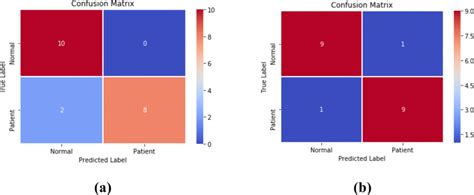 A Confusion Matrix Of Random Forest Method Using Daubechies Db5 Download Scientific Diagram