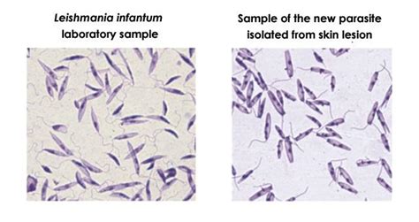 Cutaneous Leishmaniasis Parasite