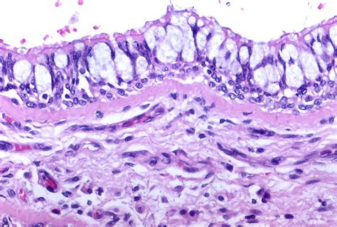 What Is A Goblet Cell A Knowledge Archive