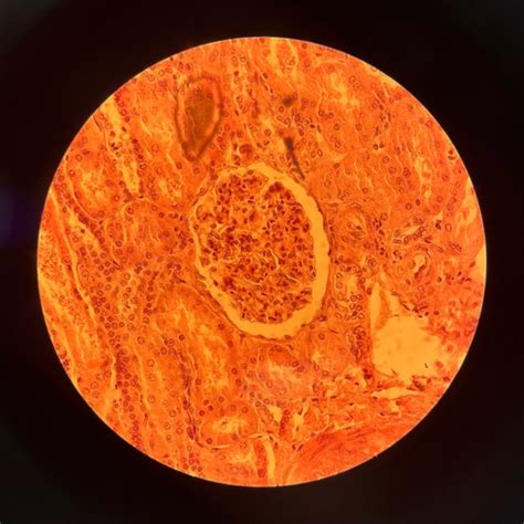 Mt636 Lab Tissue Microscope Slides Flashcards Quizlet