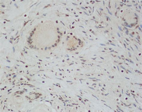 Pulmonary Tuberculosis Pathological Staining A B Distal Side Download Scientific Diagram