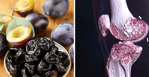 This Dry Fruit Gives Life To Weak Bones Will Prevent Osteoporosis
