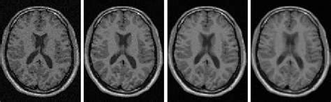Example Of Varying Tr In A Simulated Spin Echo Sequence From Left To