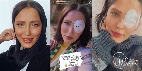 Association Humanitaire Les femmes iraniennes courageuses perdent leurs yeux mais leur cœur