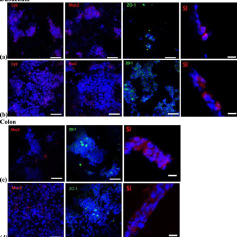 Sem Pictures Of Primary Duodenum Cells And Primary Colon Cells Cultured