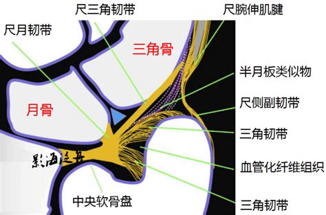 三角纤维软骨复合体 影像ppt