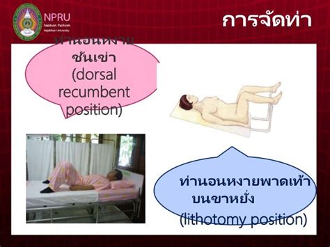 What Is Lithotomy Position Slidesharedocs