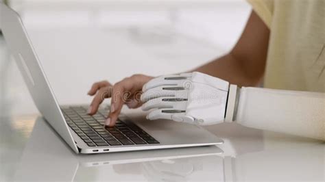 Motivated Woman Using Prosthetic Arm Working Or Learning Notebook