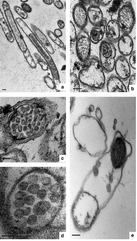 Electron Micrographs Of X Fastidiosa Thin Sections Bacteria Cells Download Scientific Diagram