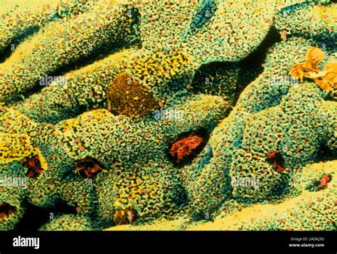 Colon Mucosa Coloured Scanning Electron Micrograph Sem Of The Mucosa Of The Large Intestine