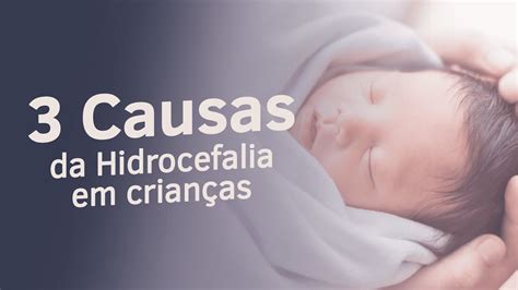 Hidrocefalia Tem Cura Descubra O Que Causa Hidrocefalia Em Beb S Youtube