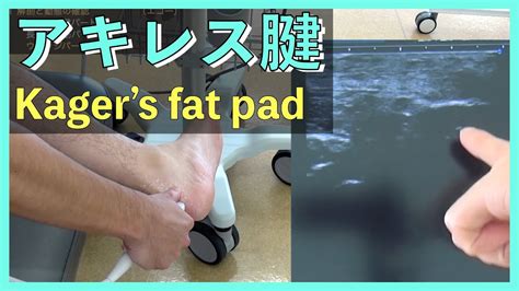 【kagers Fat Pad】アキレス腱周囲の脂肪体の動態について Youtube