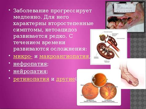 Сахарный диабет 2 типа - презентация, доклад, проект скачать